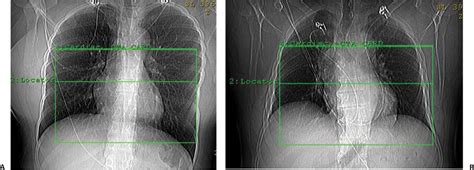 Technique Protocols Instrumentation And Radiation Dose Radiology Key