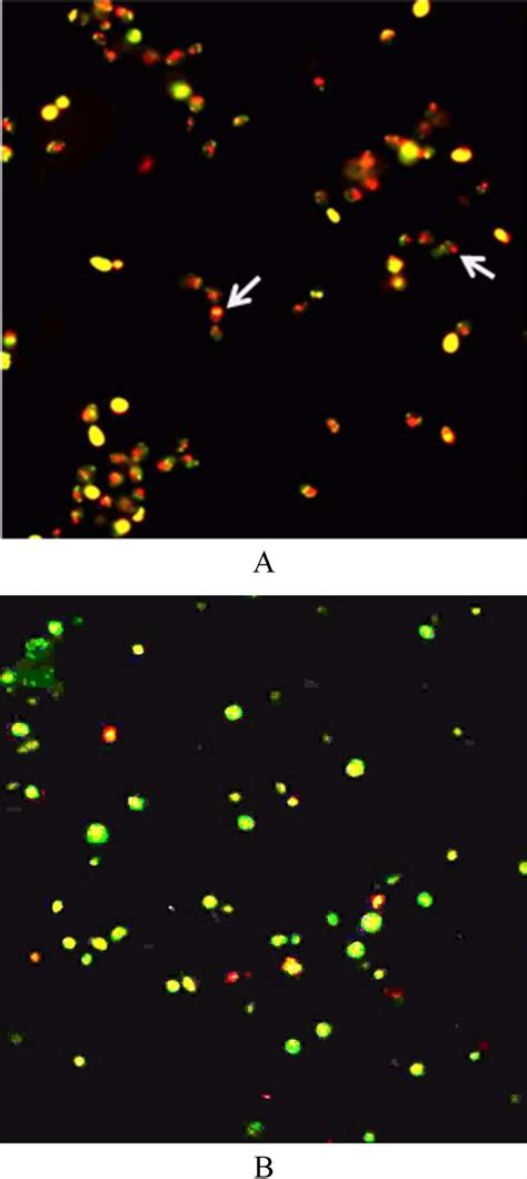 Fluorescence Microscopy Of Candida Albicans Stained With Fun I