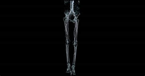 210 Veia Femoral Fotos De Stock Imagens E Fotos Royalty Free Istock