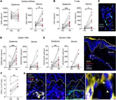 Jci Tick Feeding Modulates The Human Skin Immune Landscape To