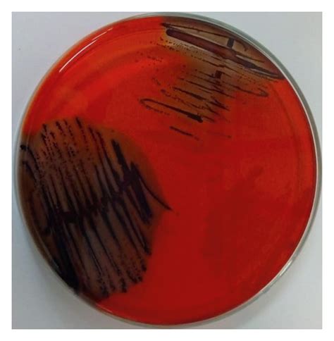 Biofilm Production By Coagulase Positive Staphylococci Isolated From