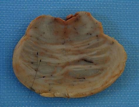 Neuroanatomie I Struktury Cns