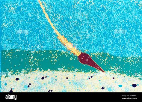 False Colour Transmission Electron Micrograph Tem Of An Egg Ovum