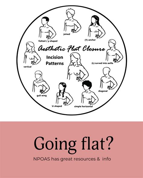 Breast If You Or A Loved One Is Considering Going Flat After