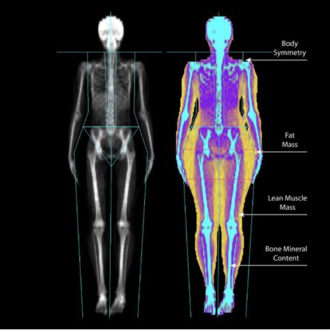 Dexa Scan Body Composition Body Lounge Park Cities