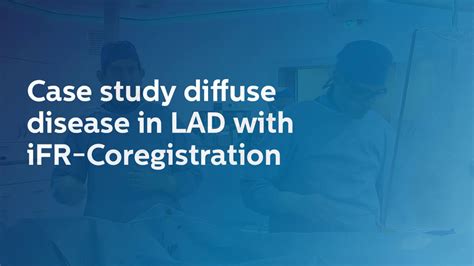 Case Study Diffuse Disease In Lad With Ifr Co Registration Youtube