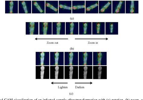 Figure 10 From Paxnet Dental Caries Detection In Panoramic X Ray Using Ensemble Transfer