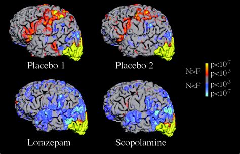 Physiology Physics Woven Fine Fmri Bold And The Beautiful