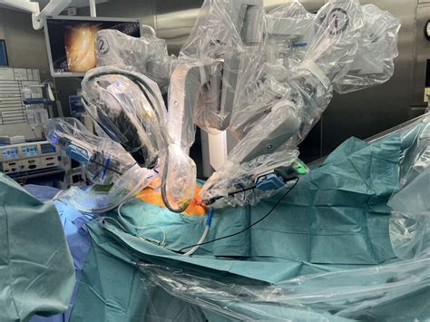 Robotic Lima Harvesting Midcab Yasser Mubarak