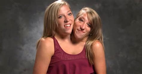 Abby Und Brittany Hensel Die Siamesischen Zwillinge