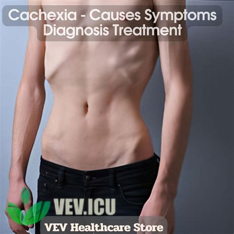 Cachexia Causes Symptoms Diagnosis Treatment