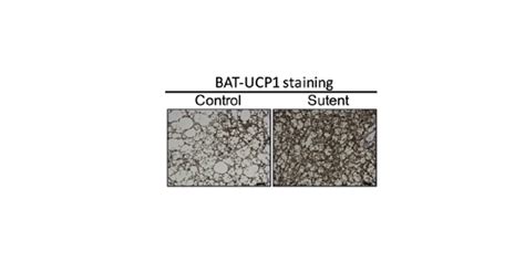 Sunitinib SU Multi Targeted RTK Inhibitor MedChemExpress