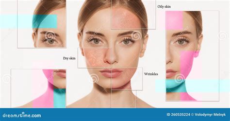 Collage Female Skin Problems Close Up Beautiful Brunette Woman And