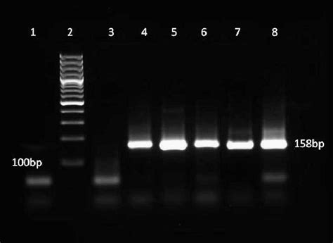Nested Reverse Transcription Polymerase Chain Reaction Using Porcine Download Scientific