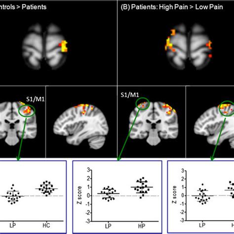 Functional Connectivity Differences Across Different Conditions A