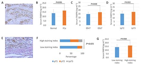 Fatty Acid Binding Protein 4 Enhances Prostate Cancer Progression By
