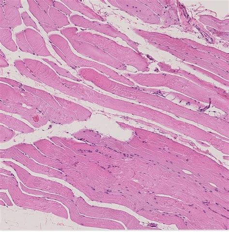 Dense Regular Connective Tissue