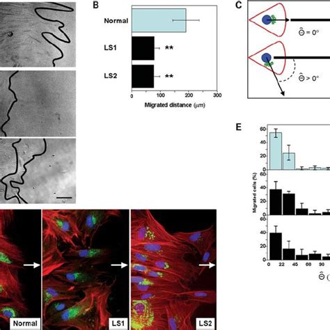 Dermal Fibroblast From Ls Patients Show Cell Migration Defects Download Scientific Diagram