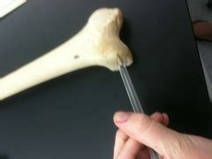 Lab Practical Axial And Appendicular Skeleton Flashcards Quizlet