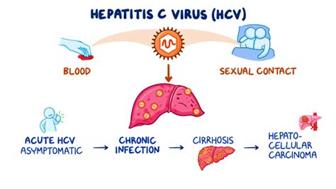 Egypt Becomes 1st Country To Achieve Gold Tier Status For Hepatitis C
