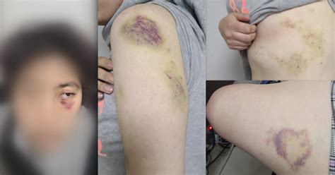 취재앤팩트 청각장애인 커플 장기간 학대지적장애인·노모 1억 원 넘게 갈취