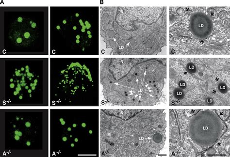 Seipin And Agpats Mrna Relative Expression In Lymphoblastoid Cell Lines