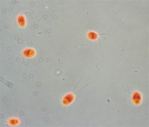 Dunaliella Salina La Microalga Che Dipinge I Laghi Di Rosa