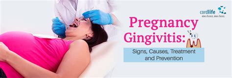 Pregnancy Gingivitis Signs Causes Treatment And Prevention