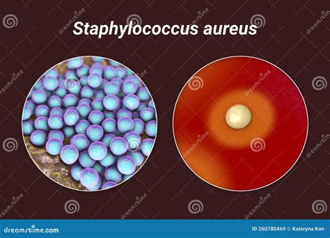 Bacteria Staphylococcus Aureus Stock Illustration 193139731 Bacteria Staphylococcus Aureus Stock Illustration 193139731