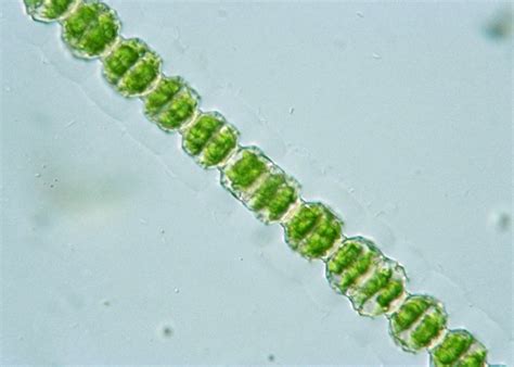 Protist Images Desmidium Coarctatum