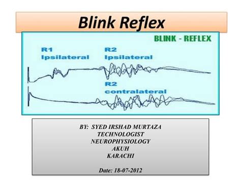 Late Responses F Wave And Hreflex Ppt
