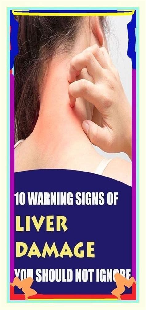 10 Warning Signals Of Liver Artofit