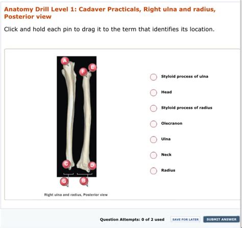 Solved Anatomy Drill Level 1 Cadaver Practicals Right Ulna
