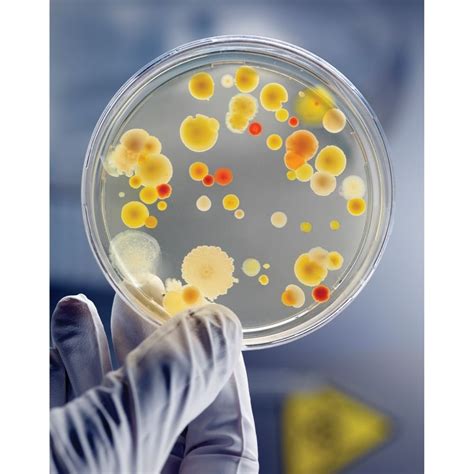 Microbiological Food Testing Services In Mumbai Id 24258861788