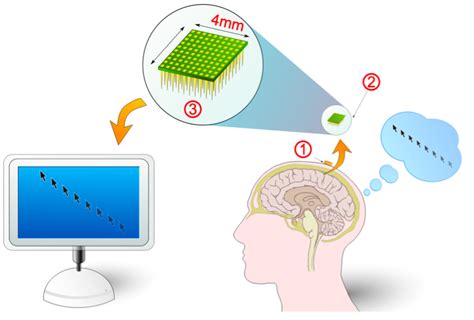 Neuralink Meging Brain And Machine Wisdomiser