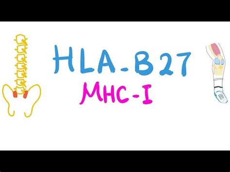 Free Video Human Leukocytic Antigen B27 From Medicosis Perfectionalis