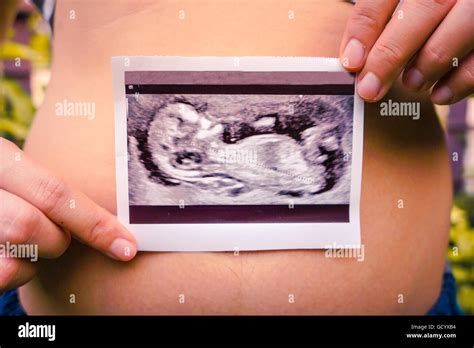 Pregnant Woman Holding Ultrasound Scan Photo Stock Image Stock Photo