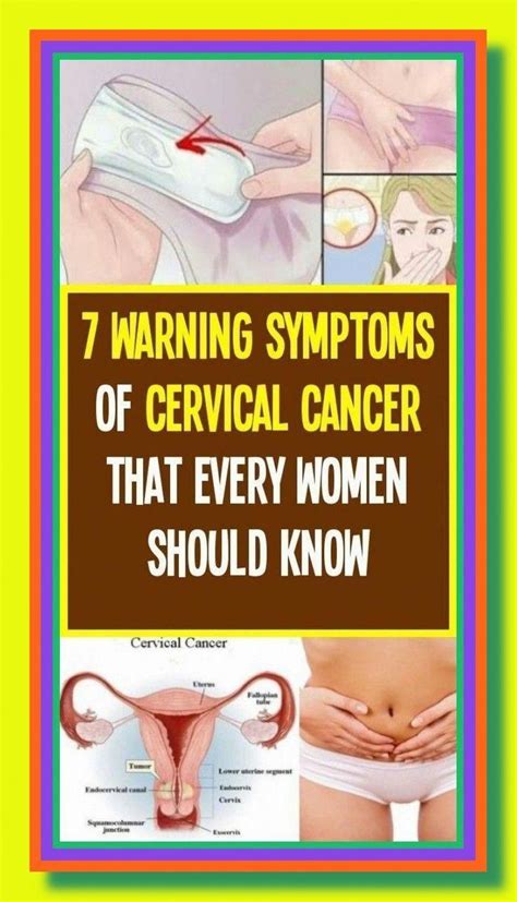 10 Warning Signs Of Cervical Cancer You Should Not Ignore Artofit