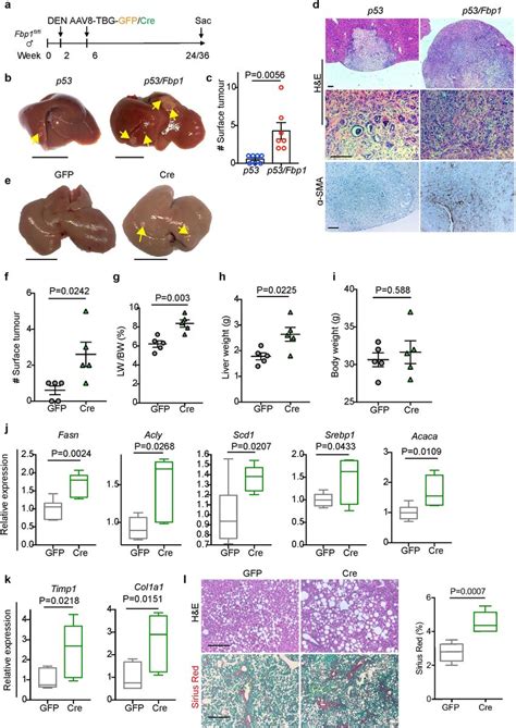 Hepatic Fbp1 Loss Promotes Tumour Progression In P53flfl And Nafld