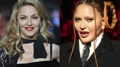 Madonna está desesperada por volver a tener su apariencia natural