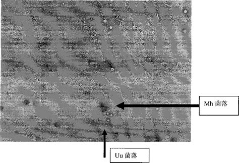 Genitourinary Tract Mycoplasma Culture Medium And Detect Method Thereof