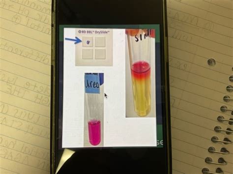 Lab Final Flashcards Quizlet