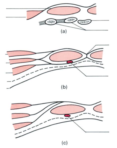 Transverse Section Of The Abdomen Above The Costal Margin A Above