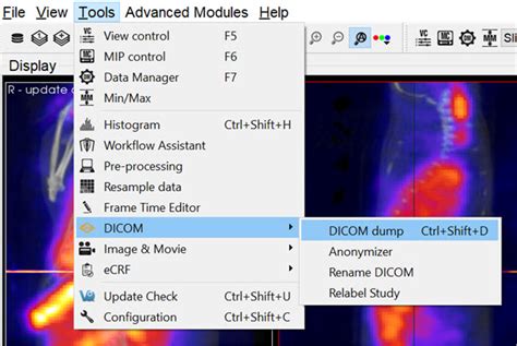 Dicom Tools Vivoquant User Manual