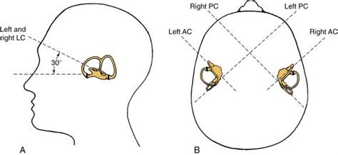 Anatomy Of The Vestibular System Ento Key