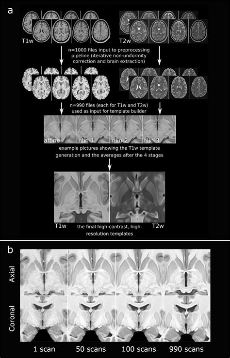 Workflow For The Generation Of The Multimodal High Resolution Mri Download Scientific Diagram