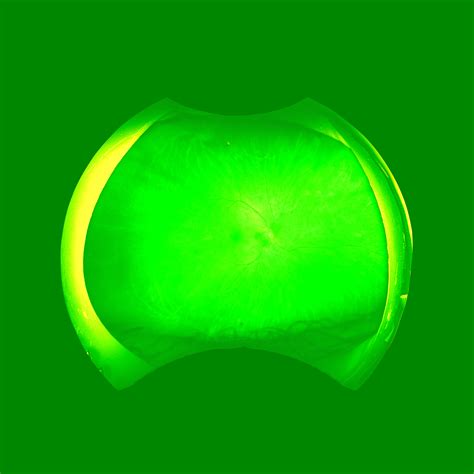 Getting Green Color Image After Converting Dicom · Issue 1790