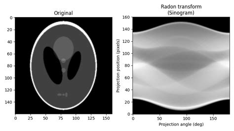 Radon Transform — Skimage 0220 Documentation