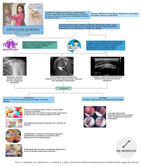 Capsulitis Adhesiva Dr Osteocito Udocz