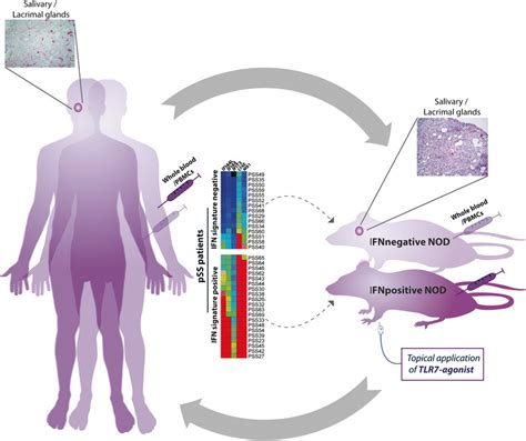 Primary Sjögrens Syndrome A Back And Forth Interplay From Mouse To